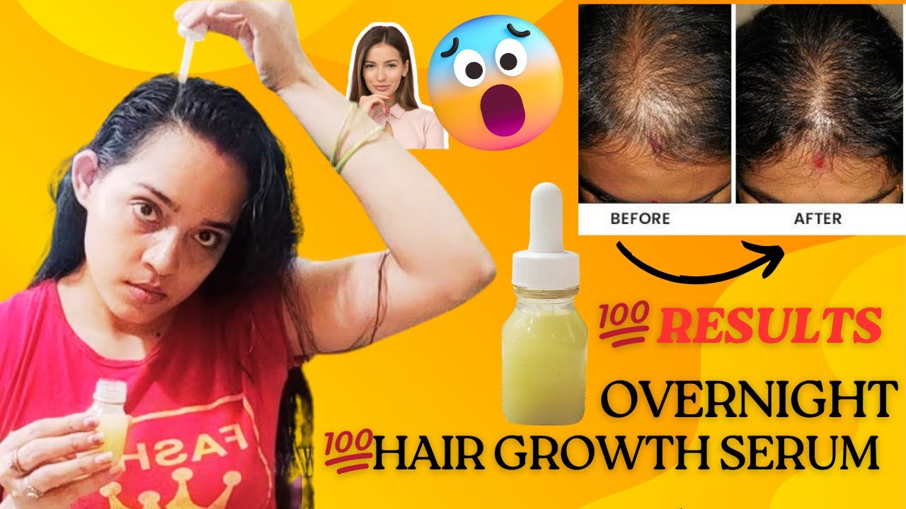 💯Hair Re-Growth Serum at Home| How to get long thick & strong hair | घर ...