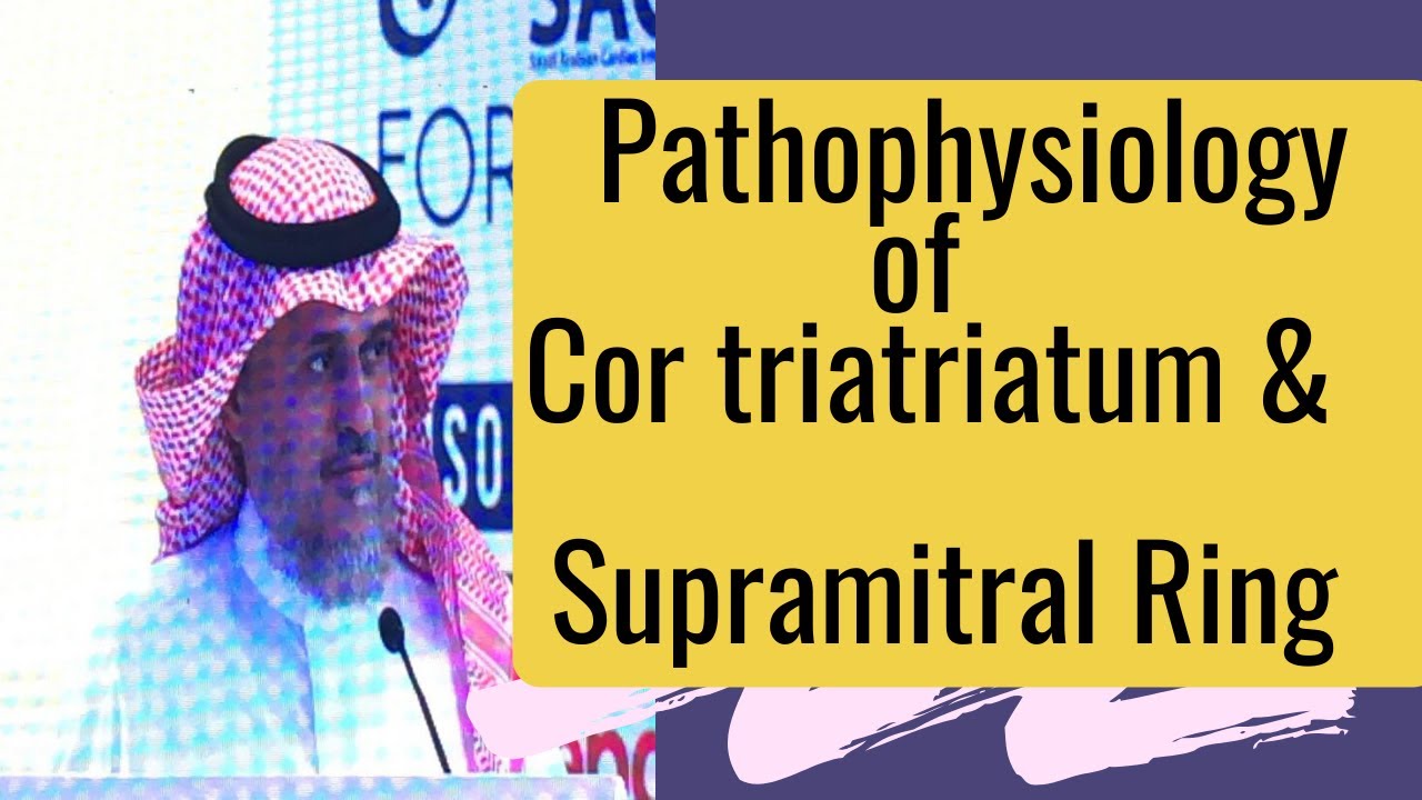 Pathophysiology of Cor triatriatum & Supra-mitral Ring by Dr. Jameel Al ...