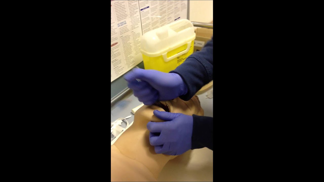 LMA Insertion - YouTube