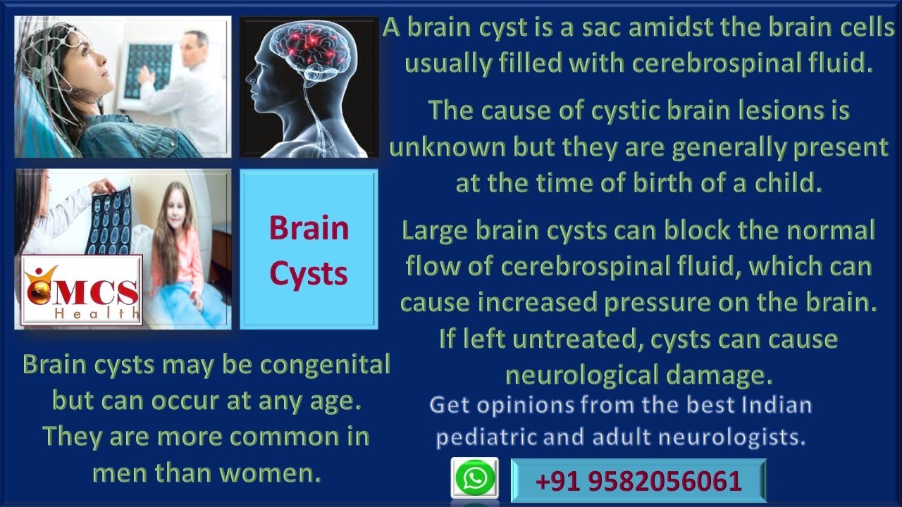 Brain Cyst Types And Treatments In India Best Medical Tourism