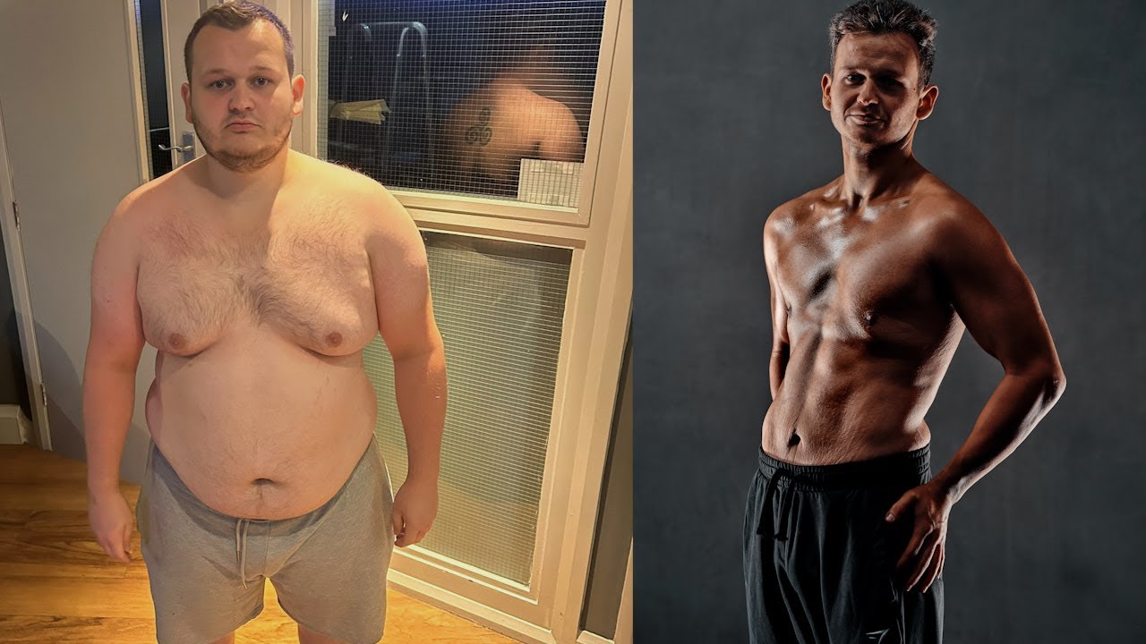 Loose Skin & Body Recomposition After Massive Weight Loss — Month 1 ...
