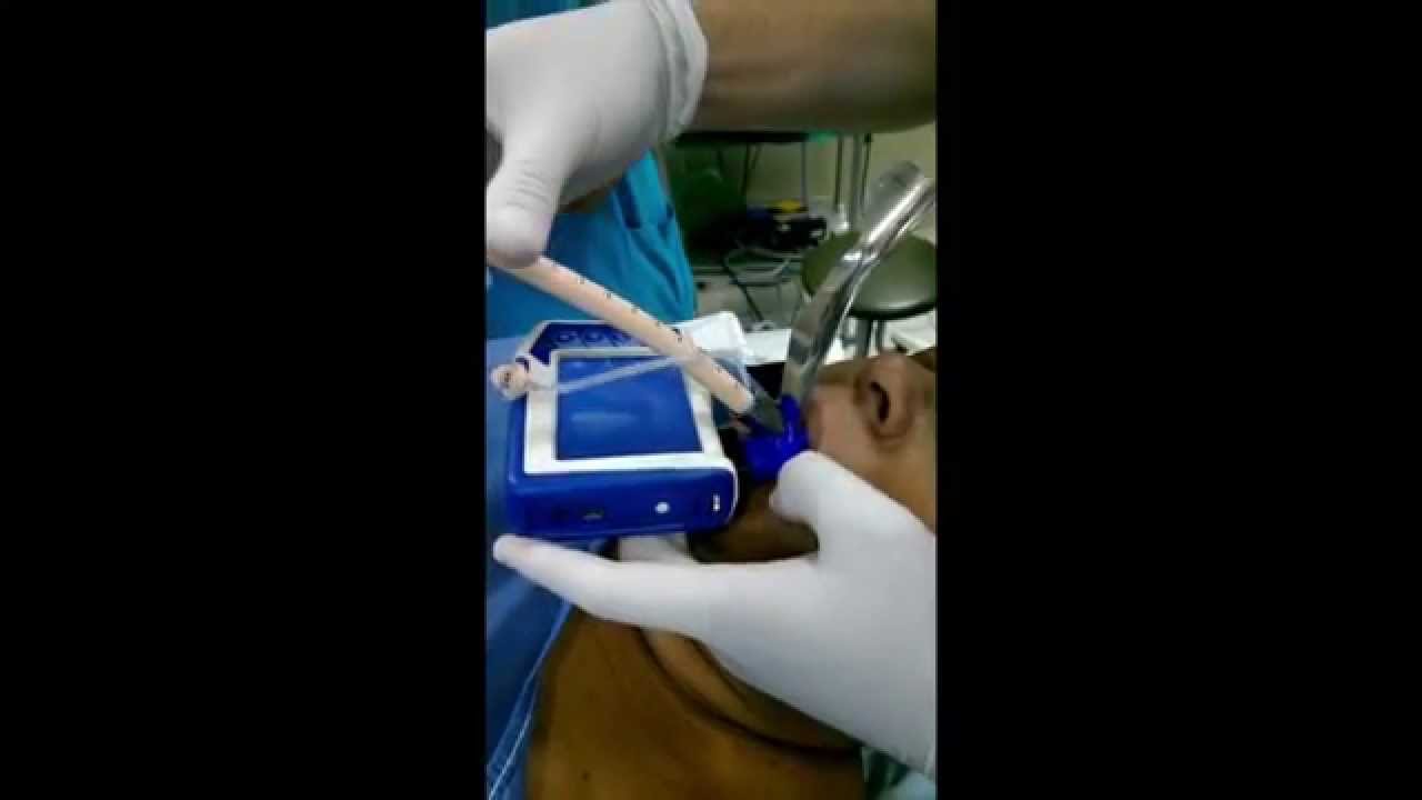 Intubación con LMA Ctrach - YouTube