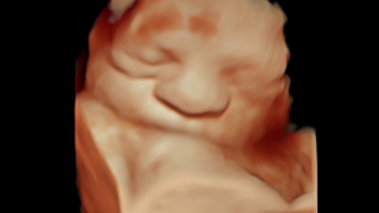 Ecografia 5D en Ecosonrisas 5D - YouTube