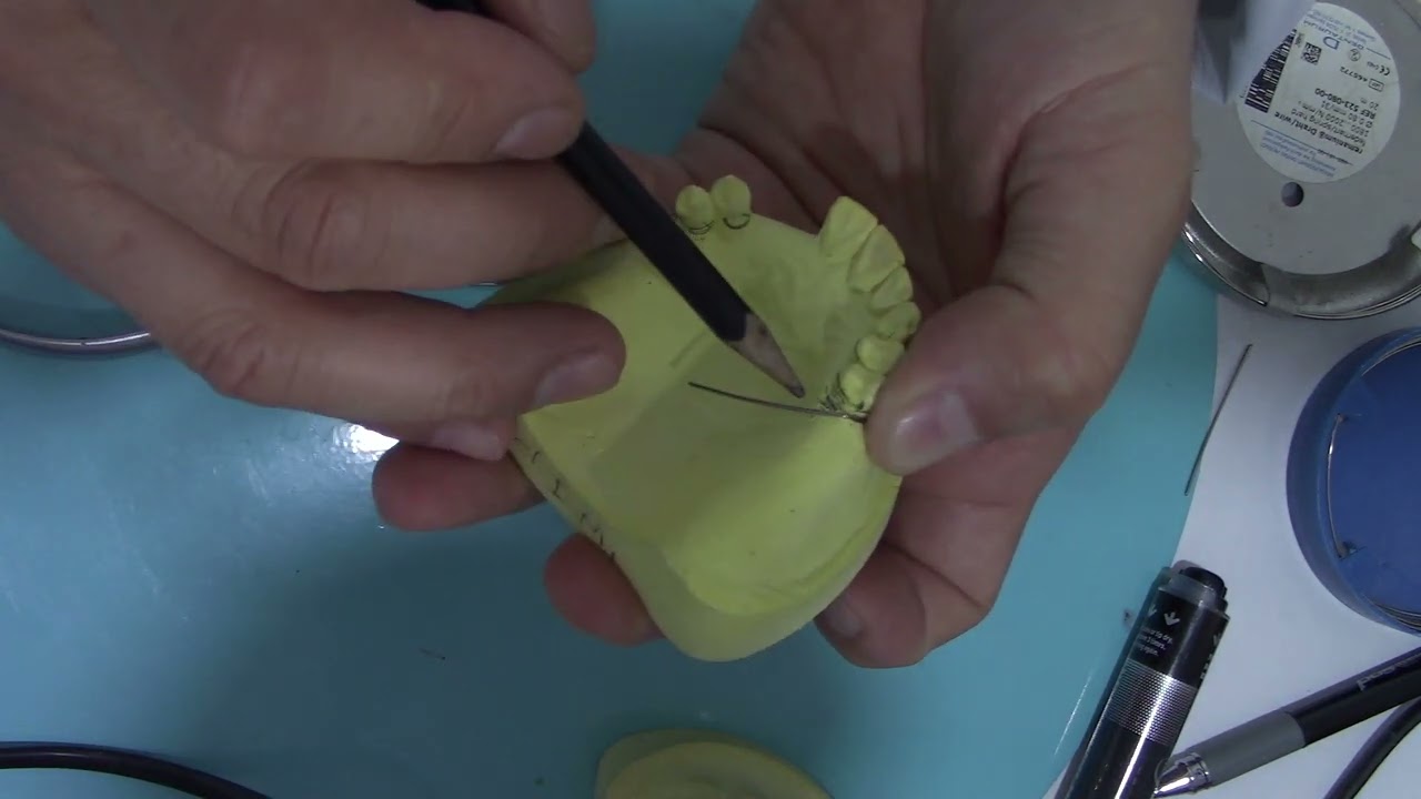 Clasp bending - YouTube