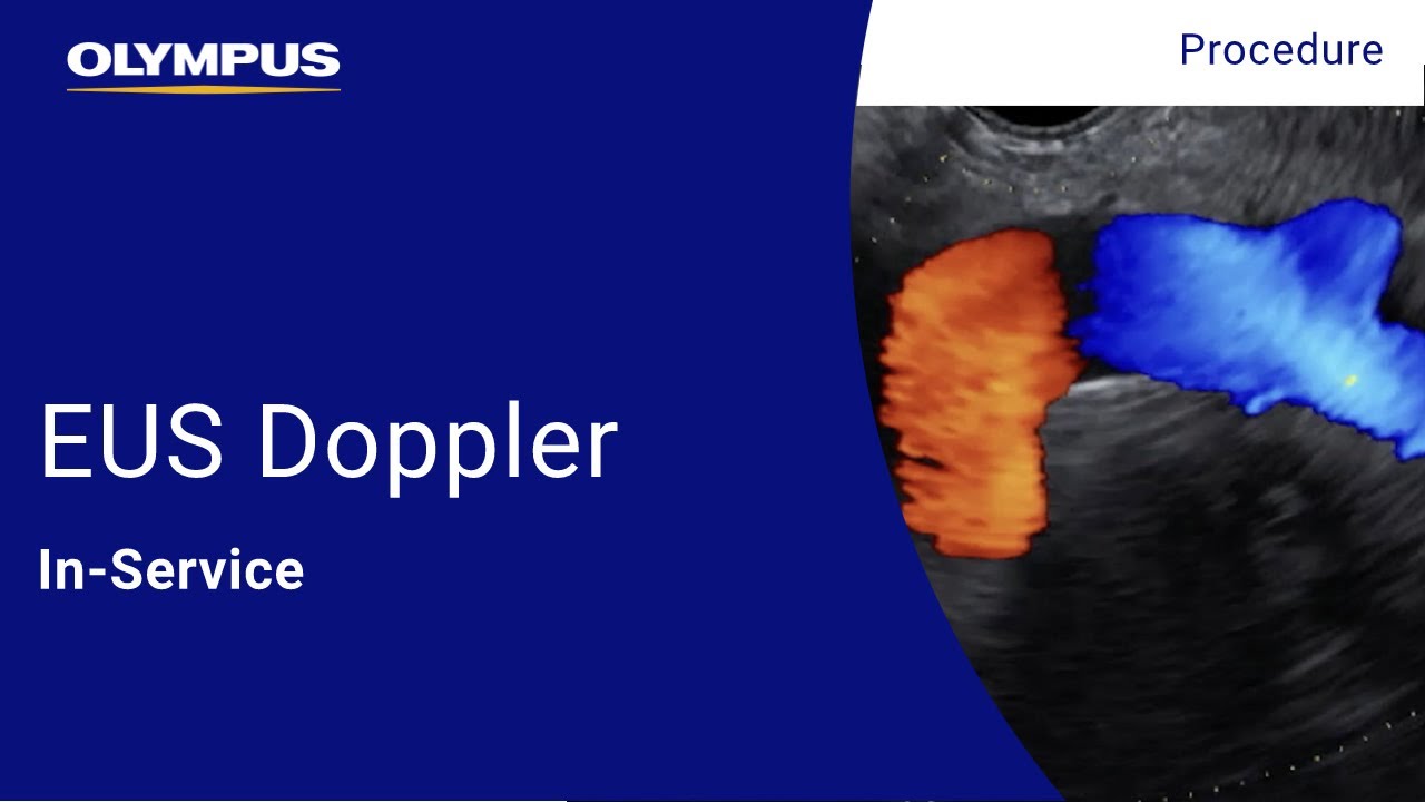 EUS Doppler In Service - YouTube