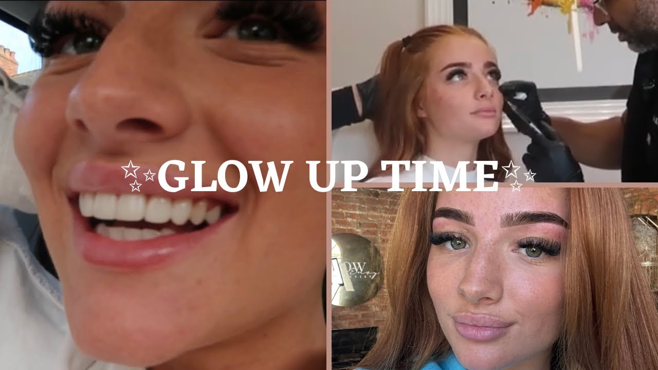 EXTREME GLOW UP WITH ME!!! New TEETH, LIPS, LASHES etc! | SUMMER HARTE ...