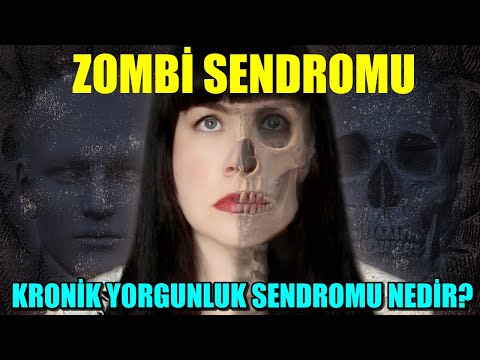 ZOMBİ SENDROMU- KRONİK YORGUNLUK SENDROMU NEDİR VE NASIL KURTULURSUN?