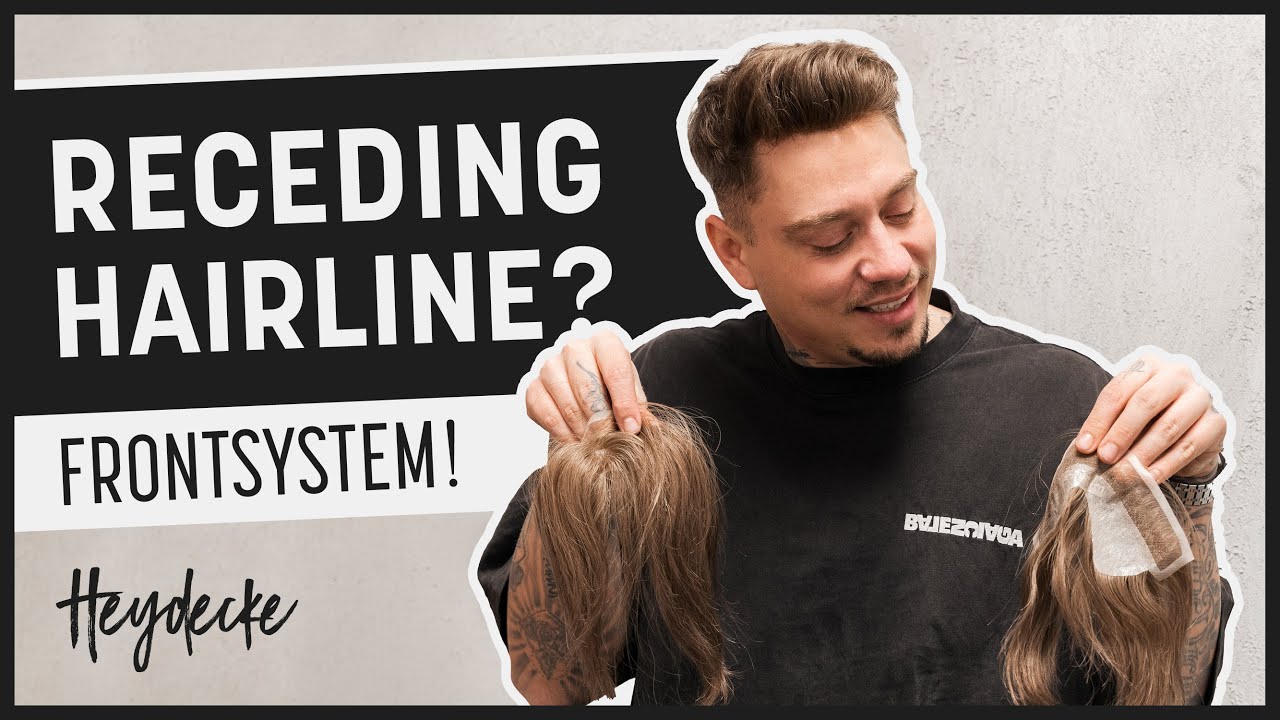 Front system: THE SOLUTION to a receding hairline | Our special ...