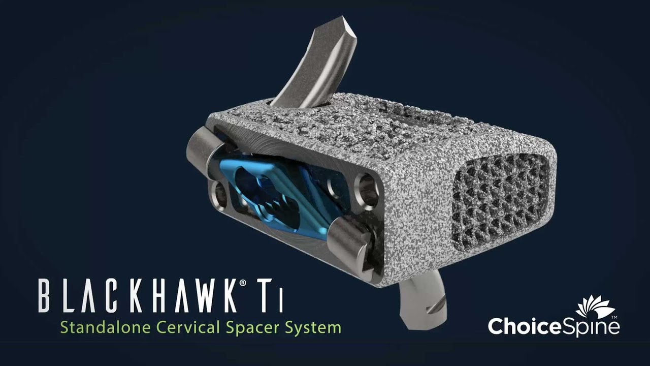 Blackhawk® Ti Cervical Standalone Spacer System - YouTube