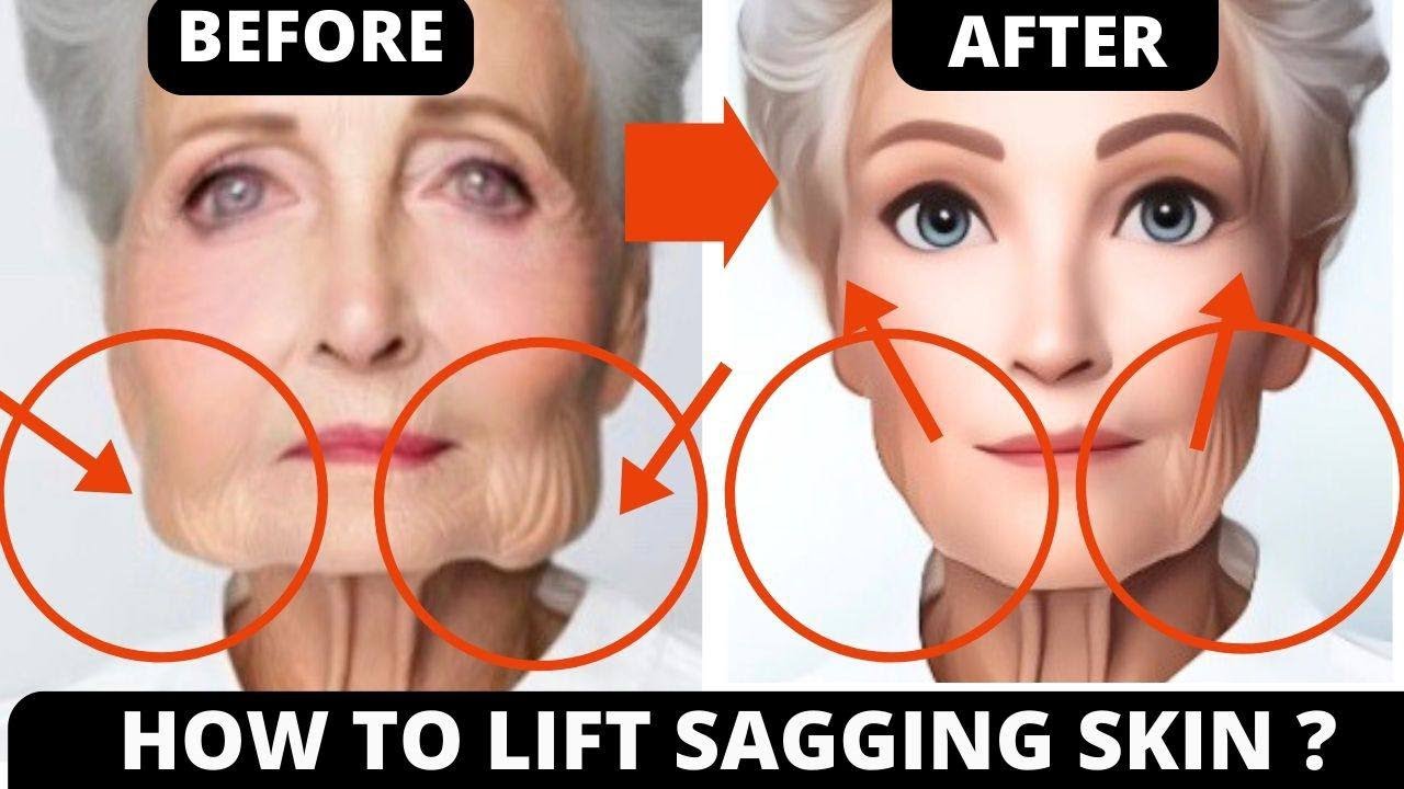 11 MIN 🔥 HOW TO LIFT SAGGING SKIN ? SAGGY JOWLS, CHEEKS LIFT | HOW TO ...