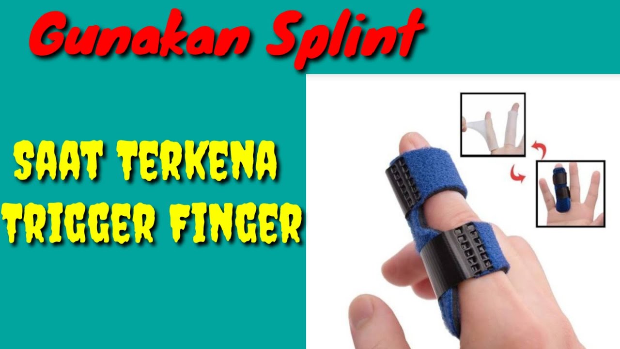 Alat/Terapi Tambahan Jika Terkena Trigger Finger / Jari Kaku. - YouTube