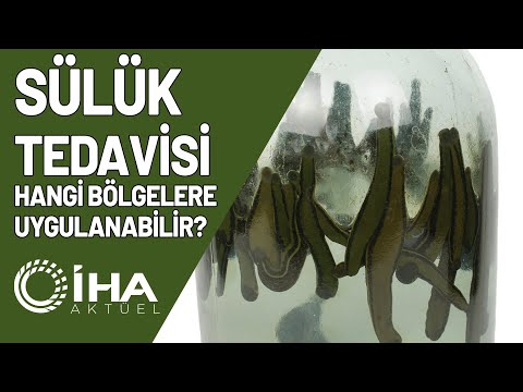 Sülük Tedavisi Hangi Bölgelere Uygulanabilir