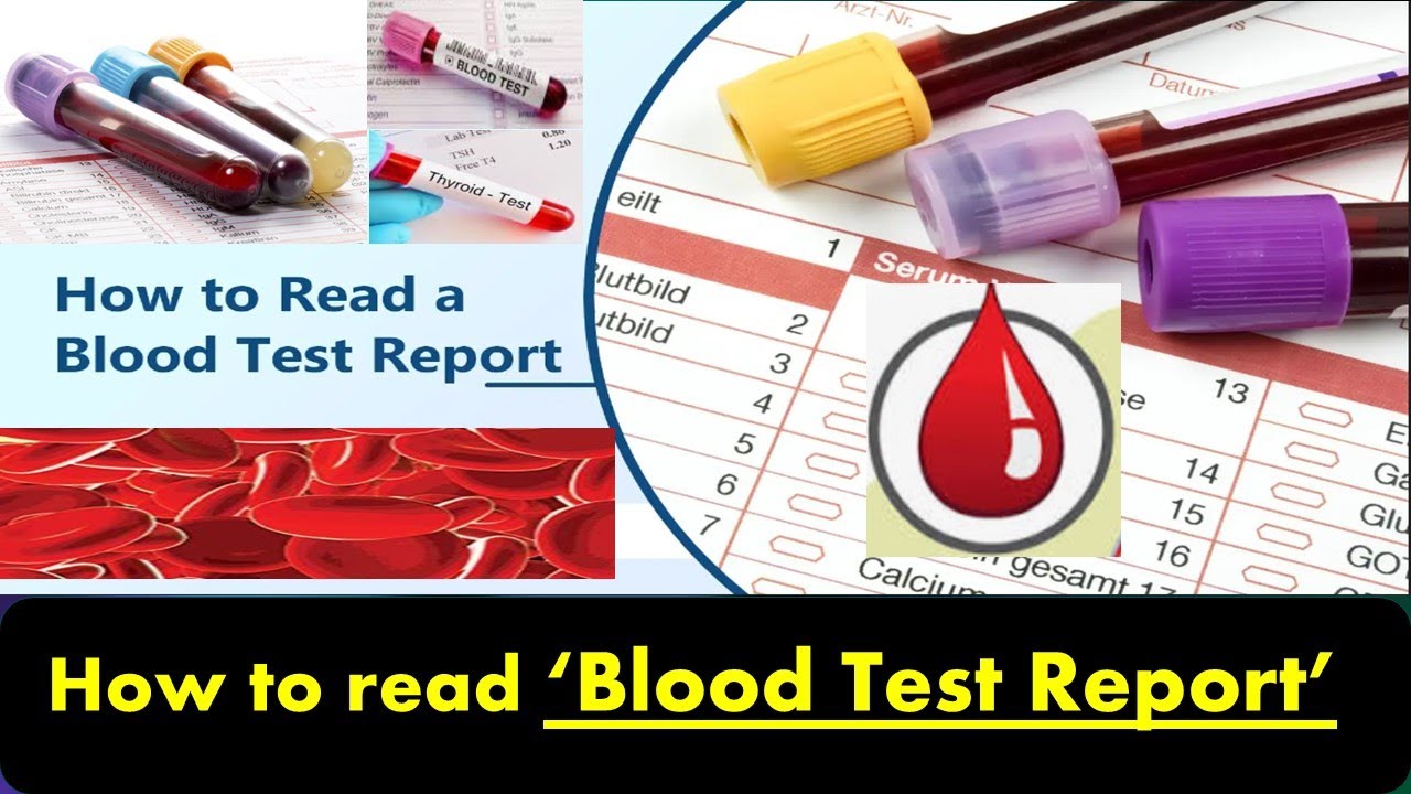How to read your blood test report #BloodHealth#CompleteBloodCount# ...