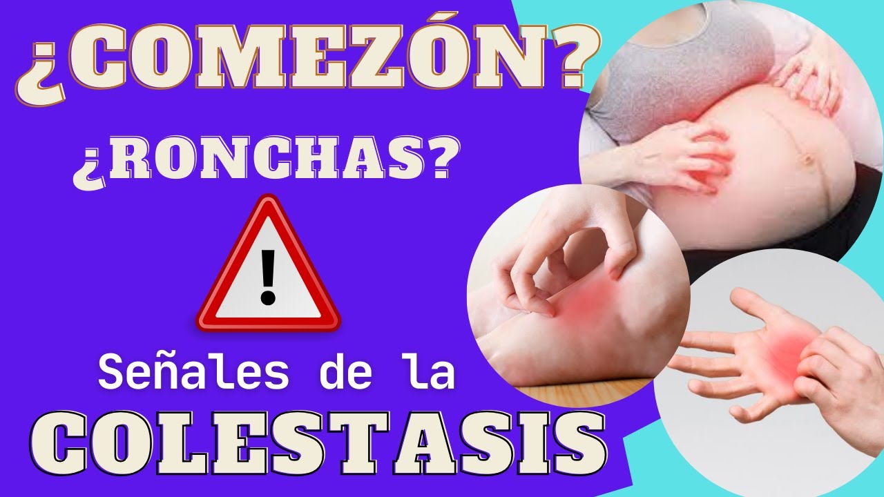 TODO sobre la COLESTASIS en el embarazo 🤰 - YouTube