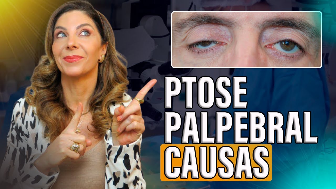 Entendendo as Causas da Ptose Palpebral - YouTube