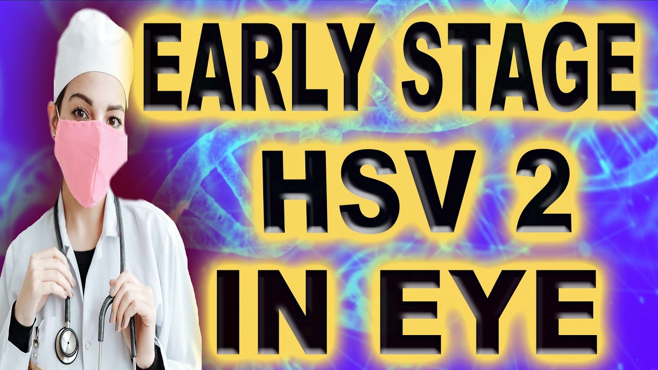 early stage HSV 2 in eye - YouTube