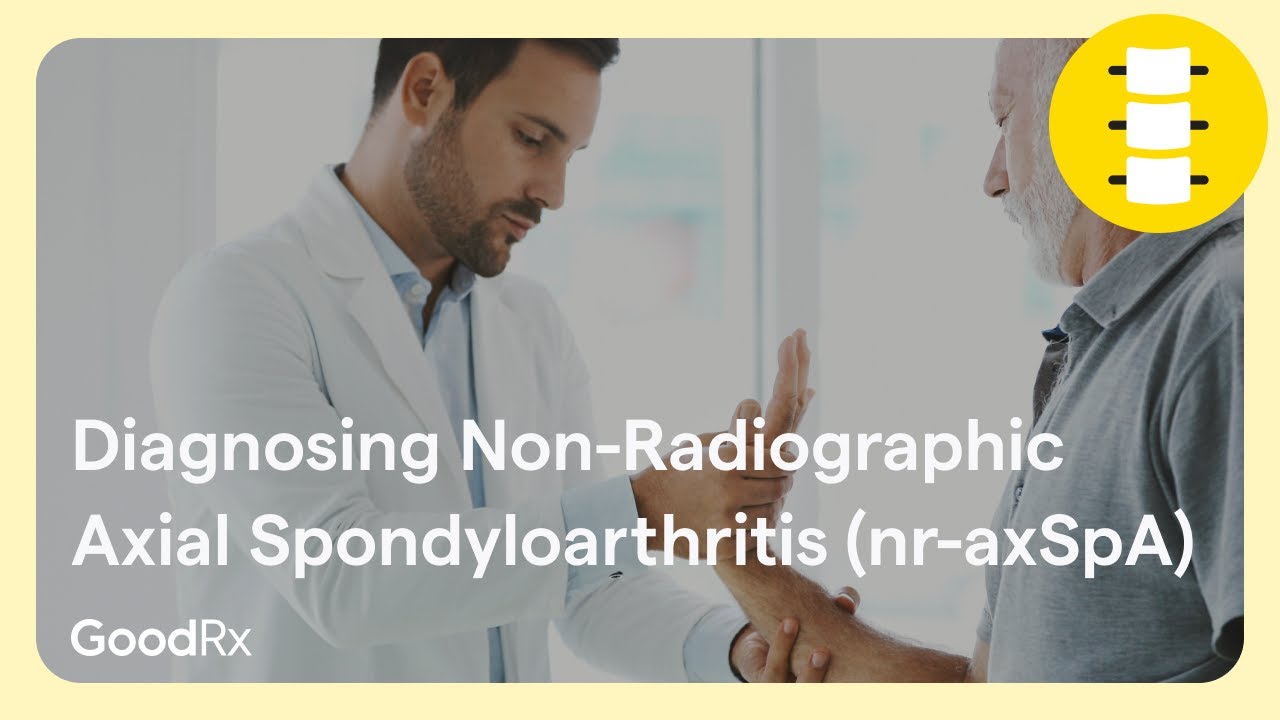 How Non-Radiographic Axial Spondyloarthritis (nr-axSpA) Is Diagnosed ...