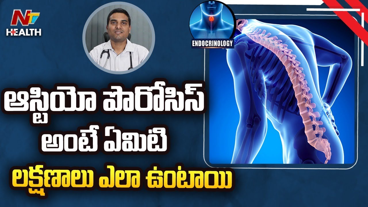 What is Osteoporosis..? | Dr Nithin Reddy | Ntv Health Telugu - YouTube