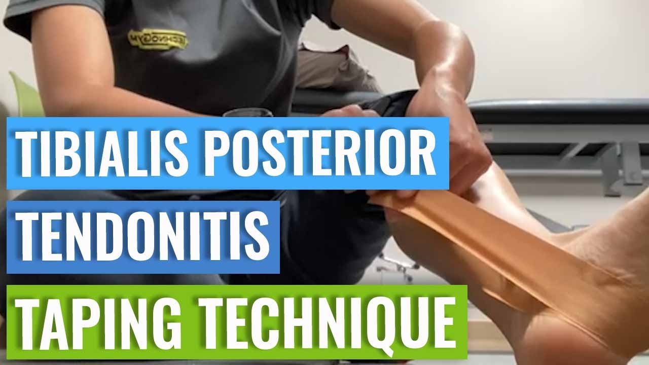 Taping For Posterior Tibial Tendonitis - YouTube