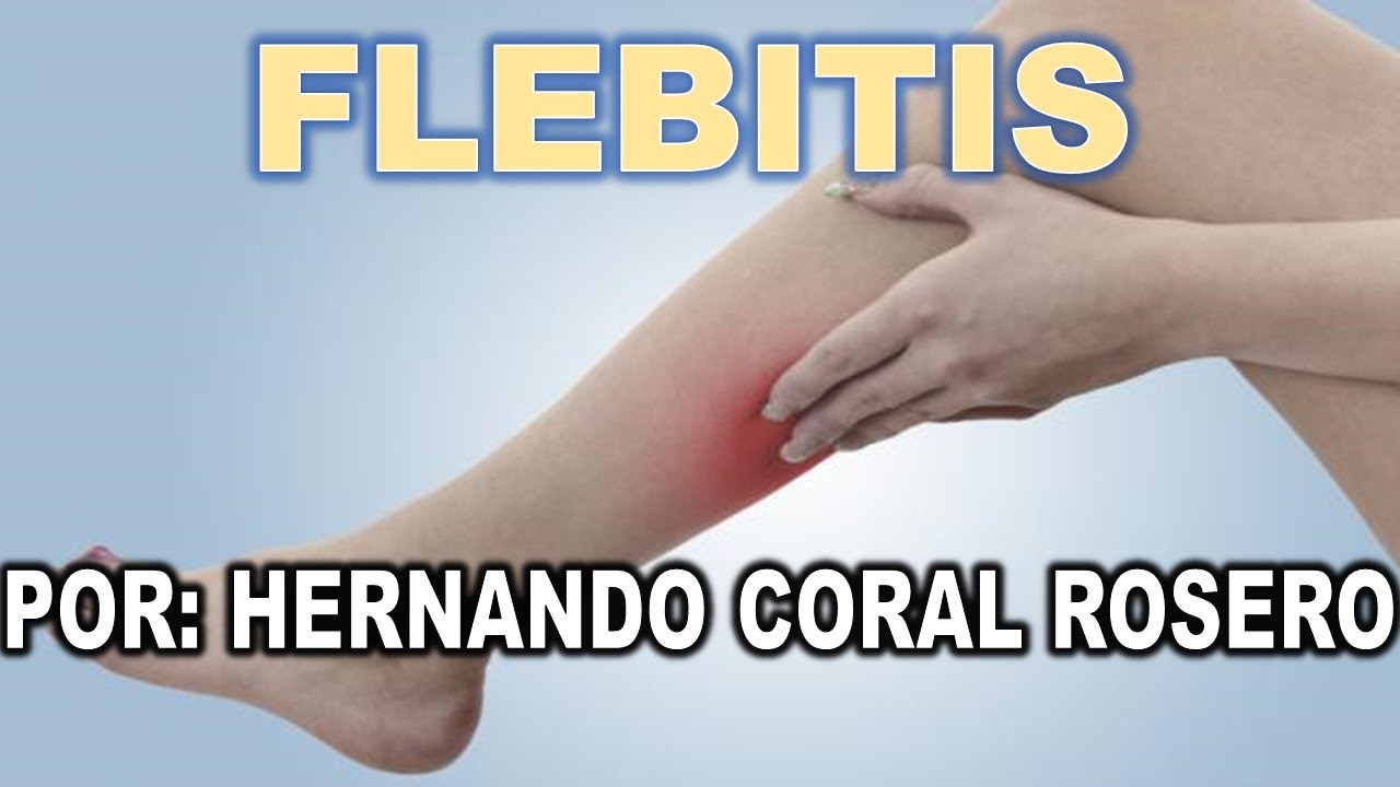 FLEBITIS - TROMBOFLEBITIS - YouTube