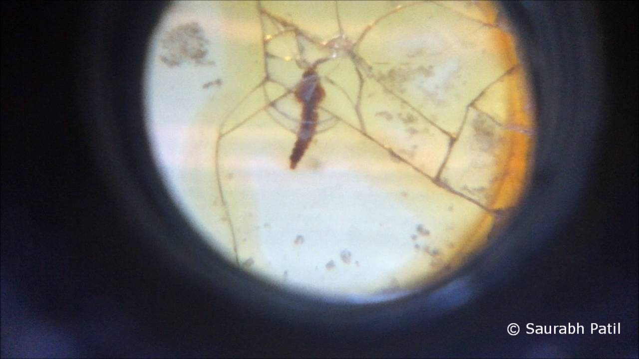 Larva of Anopheles mosquito under dissecting microscope - YouTube