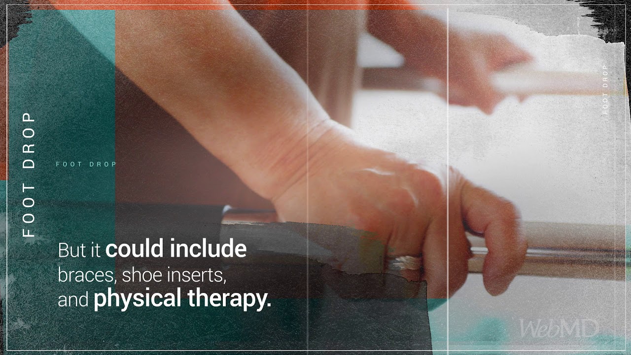 The Basics: Foot Drop | WebMD - YouTube