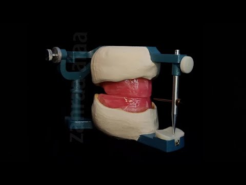 Mounting the upper and lower Bite rim / د. زهراء علاء - YouTube