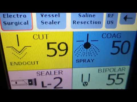 Surgical Cautery Machine - Basics of working mechanism - YouTube