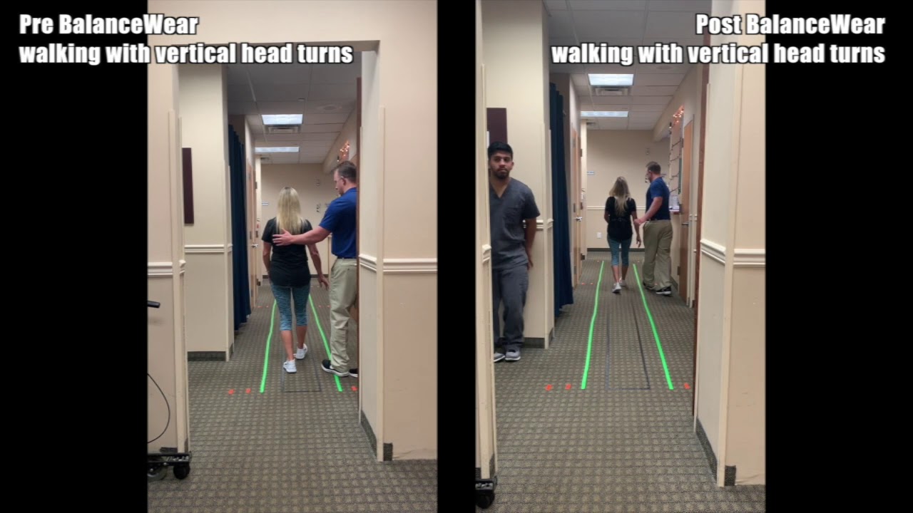 Walking With Vertical Head Turns - Concussion Management - YouTube