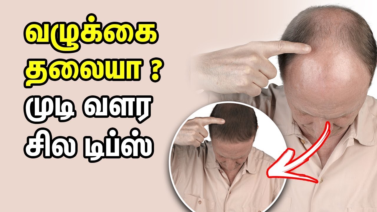 வழுக்கை தலையா? முடி வளர சில டிப்ஸ் | valukkai thalai mudi valara Tips ...