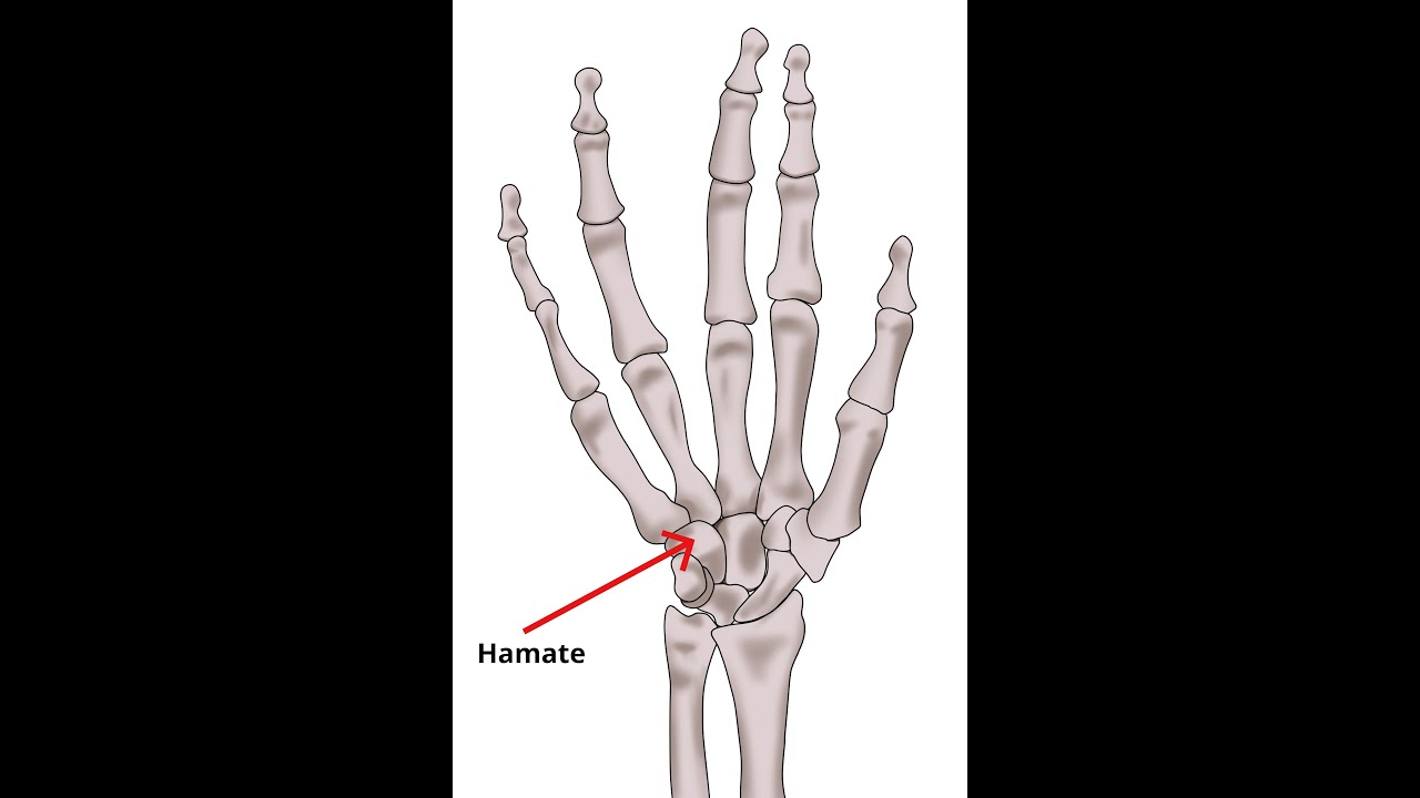 Anatomy of Hamate Carpal Bone ; Hook of hamate, Hamulus, Overview, Location, Shape ...