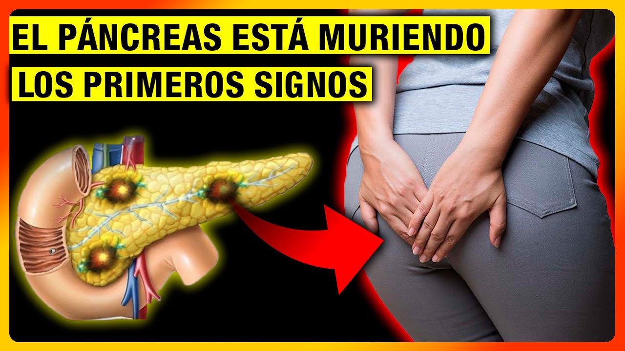 El Páncreas Se Muere Extraños Signos De Daño Pancreatico Que Debes ...