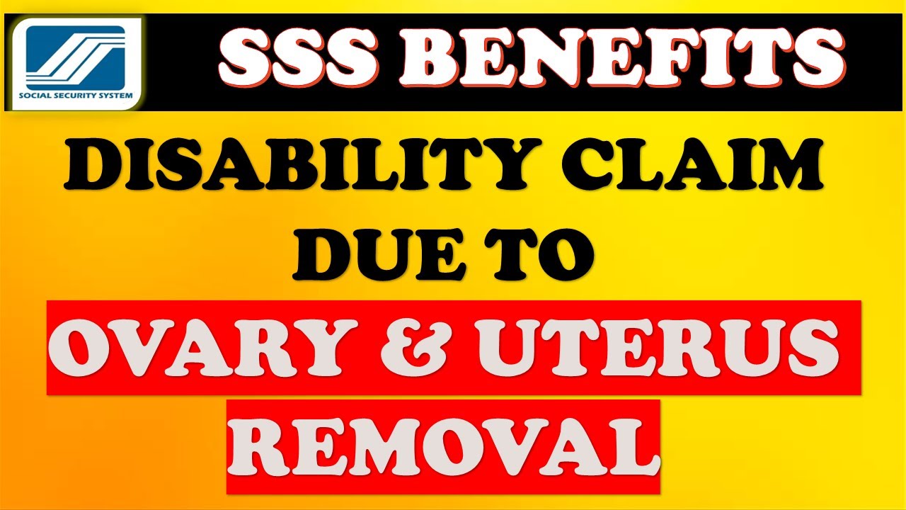 🔴 SSS DISABILITY BENEFITS DUE TO REMOVAL OF UTERUS AND OVARY - YouTube