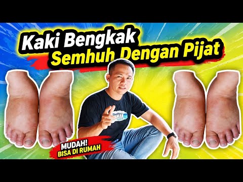 PIJAT REFLEKSI KAKI BENGKAK