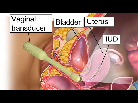 Vagina Anatomy ( part 2 )