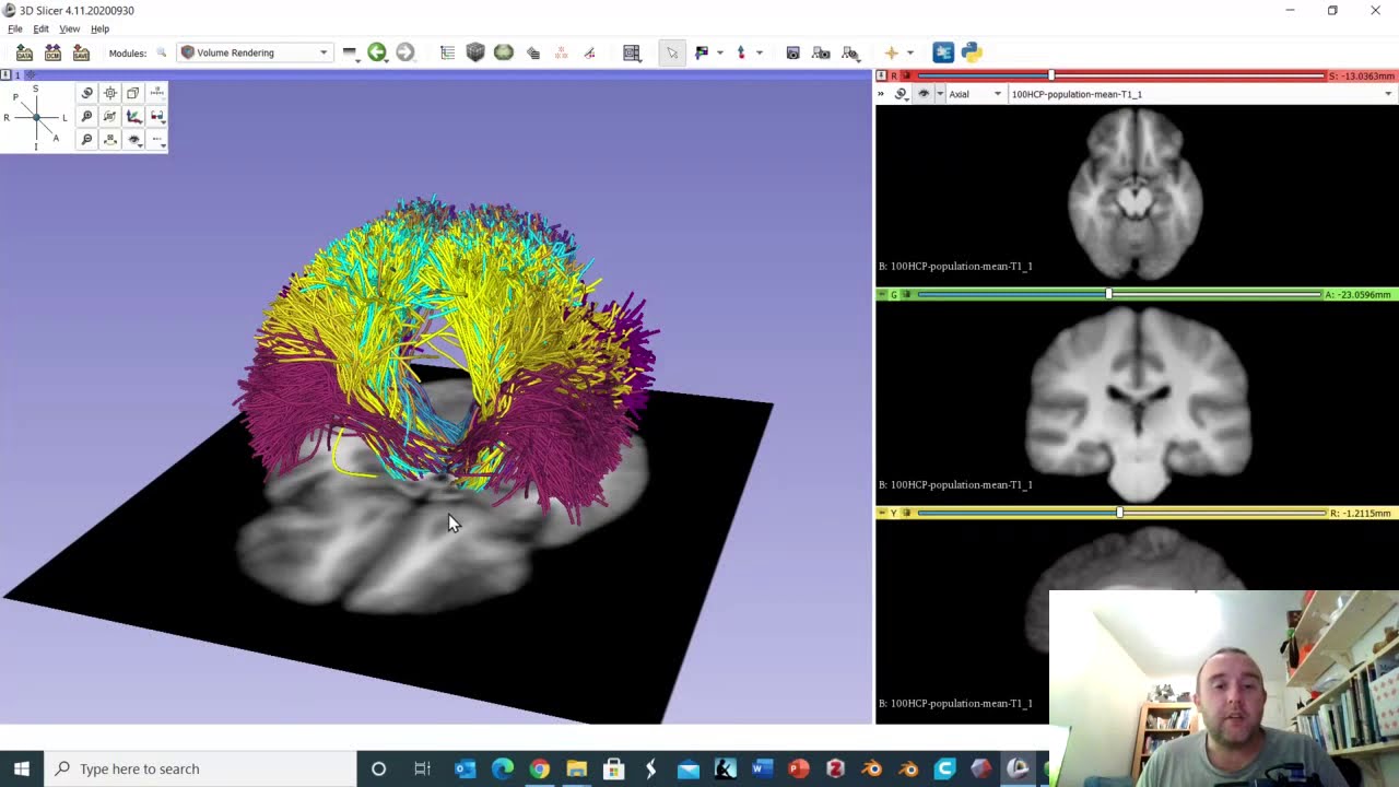 Demonstration of the motor pathways using diffusion MRI data - YouTube