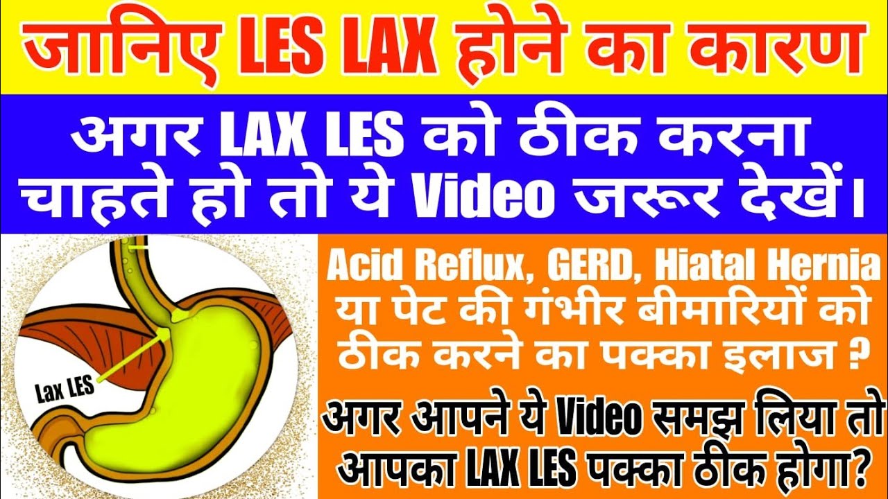 Acid Reflux GERD Hiatal Hernia में LES LAX होने का कारण और पक्का इलाज ...