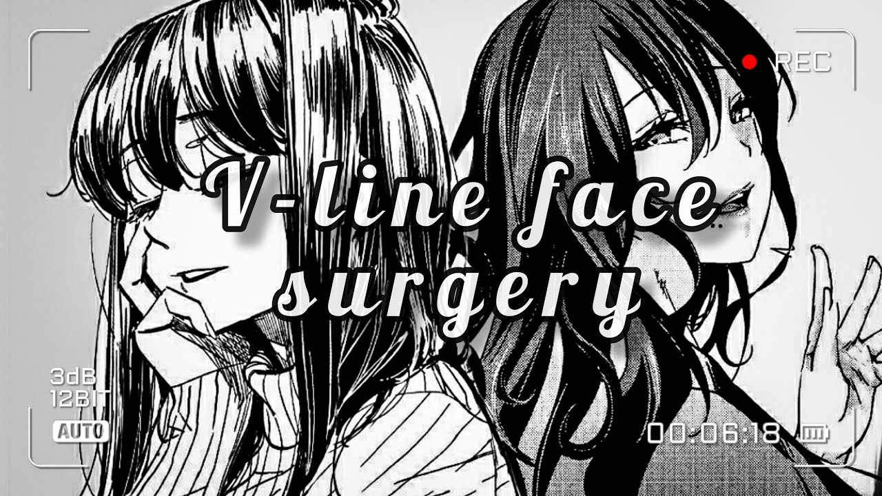 V-line face surgery ‧₊˚ Defined jawline & attractive cheek dimples ...