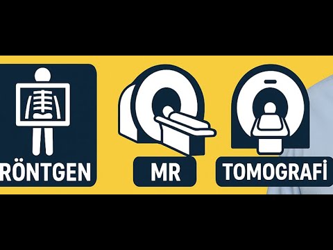 Röntgen, MR, Tomografi: Farkları Ne? Ne Zaman Hangi Görüntüleme Gerekir?