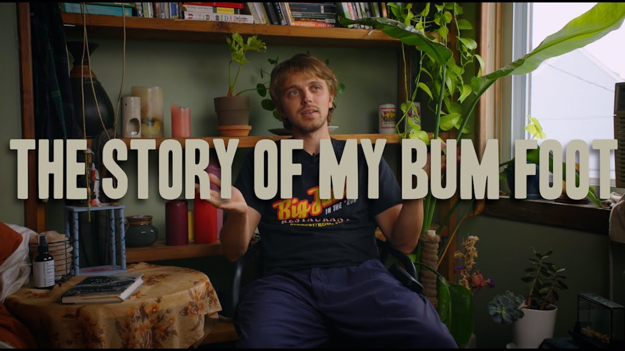 The Story of My Bum Foot (Broken Talus Recovery) - YouTube