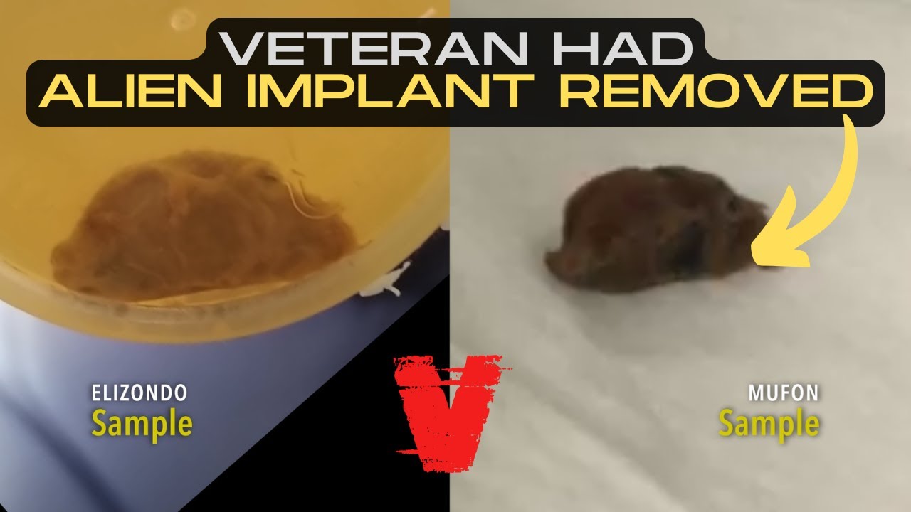 Exclusive Interview w/ Veteran Who Had Alien Implant Removed - YouTube