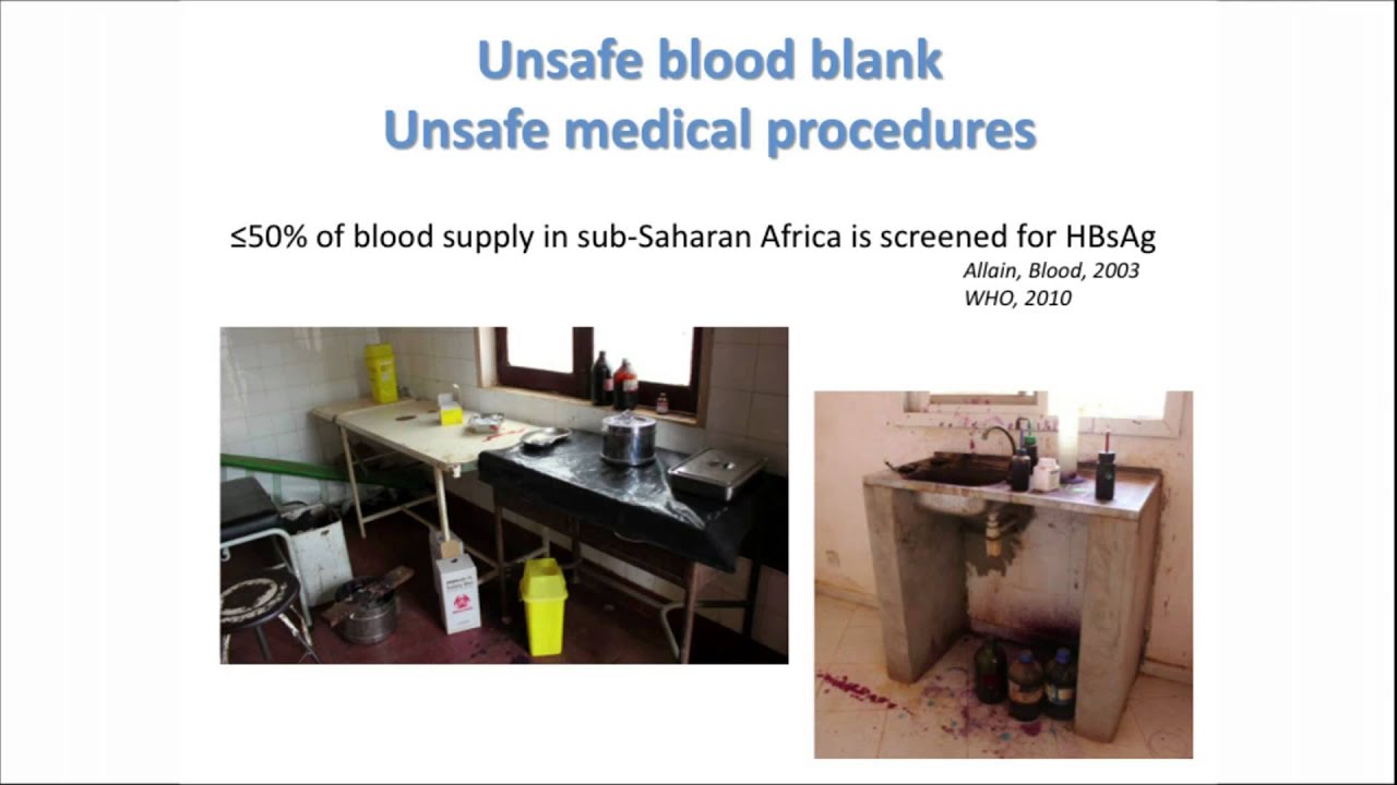 : MAUD LEMOINE: MANAGING HBV IN THE RESOURCE CONSTRAINED WORLD - YouTube