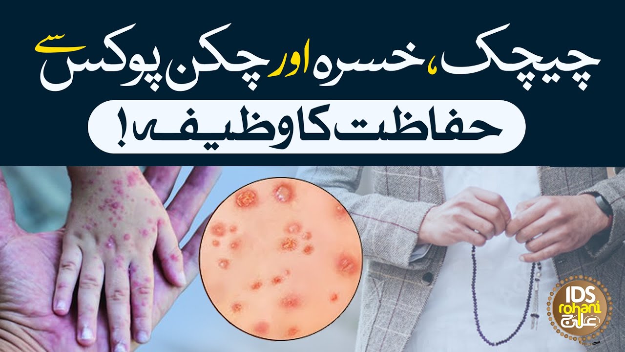 Chechak Khasra Chickenpox Se Hifazat Ka Wazifa | Rohani Ilaaj | Mufti ...