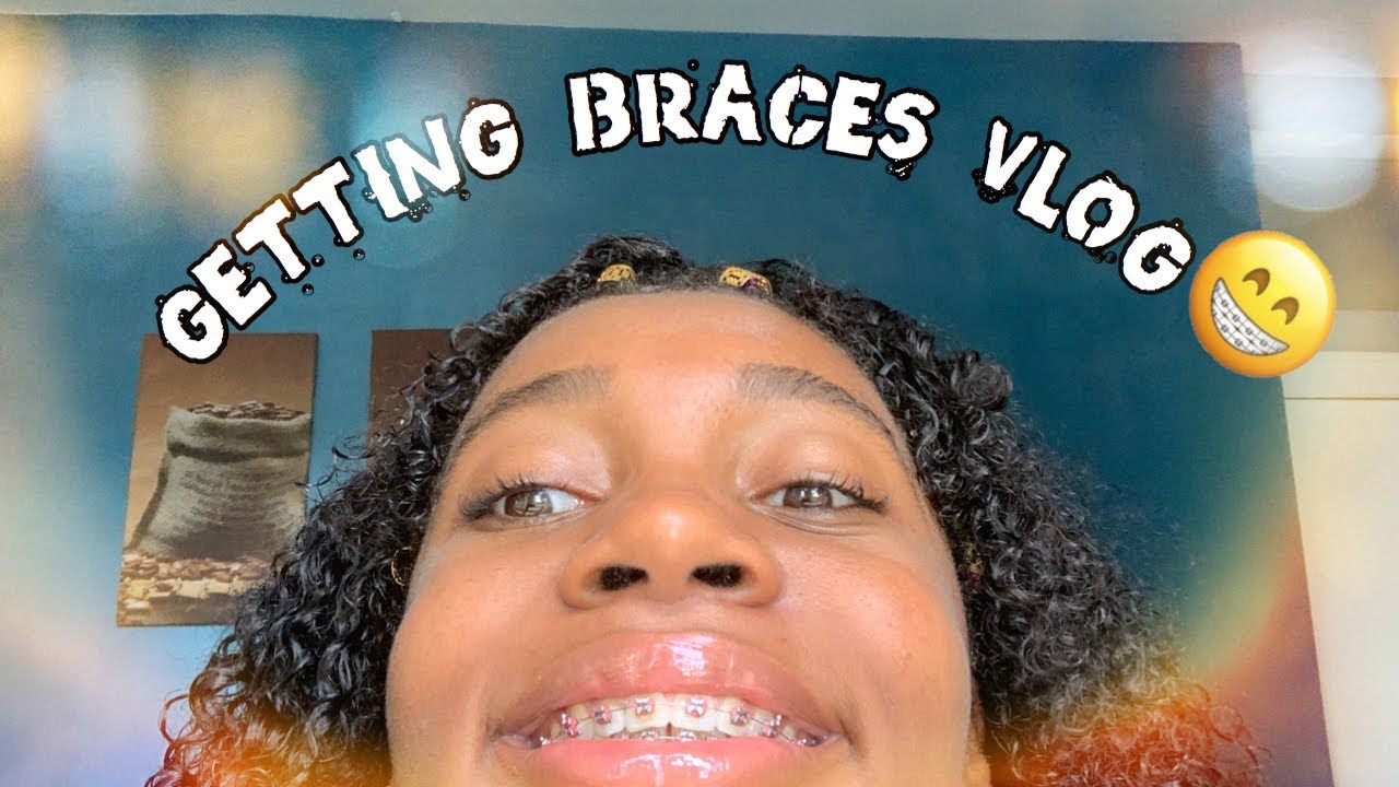 GETTING BRACES VLOG PT. 2😬 - YouTube