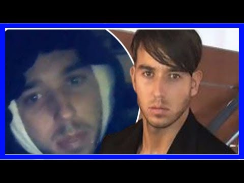 TOWIE star James Lock has £5000 worth of plastic surgery on ears after ...