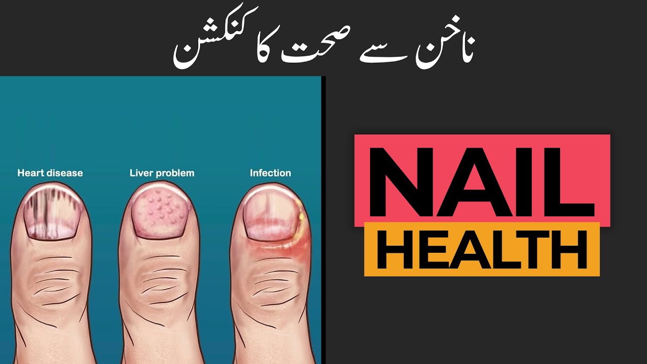 How to Improve Your NAIL HEALTH | HASH CLINICS - YouTube