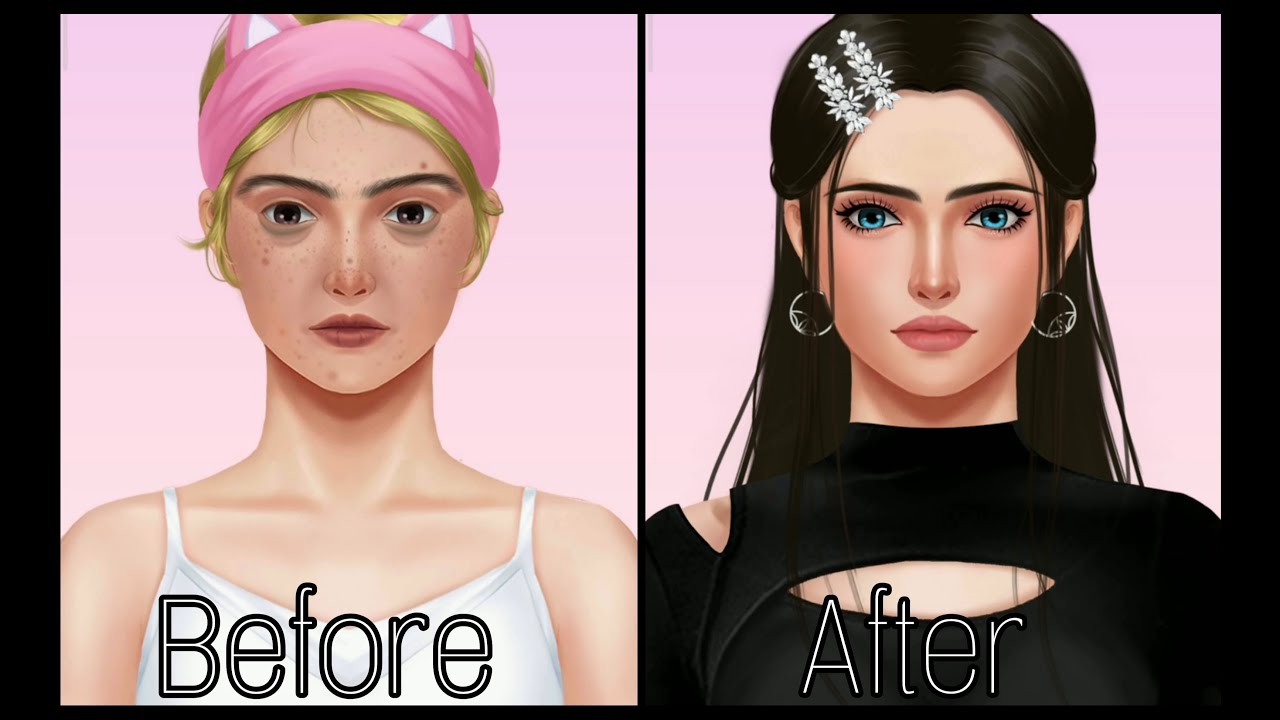 Acne pimple Treatment Animation ASMR For Feel Satisfied And Relax |Skin ...