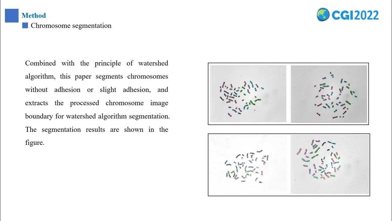 A chromosome segmentation method based on corner detection and ...