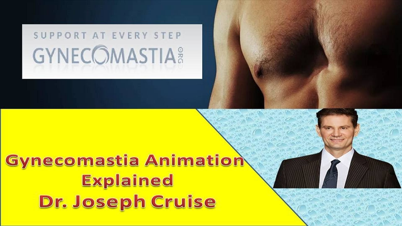 Gynecomastia Animation Explained | Dr.Joseph Cruise | Gynecomastia ...