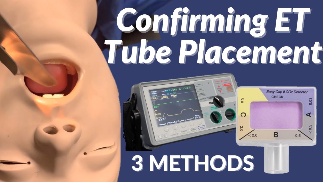 How To Confirm ET Tube Placement 3 Methods YouTube